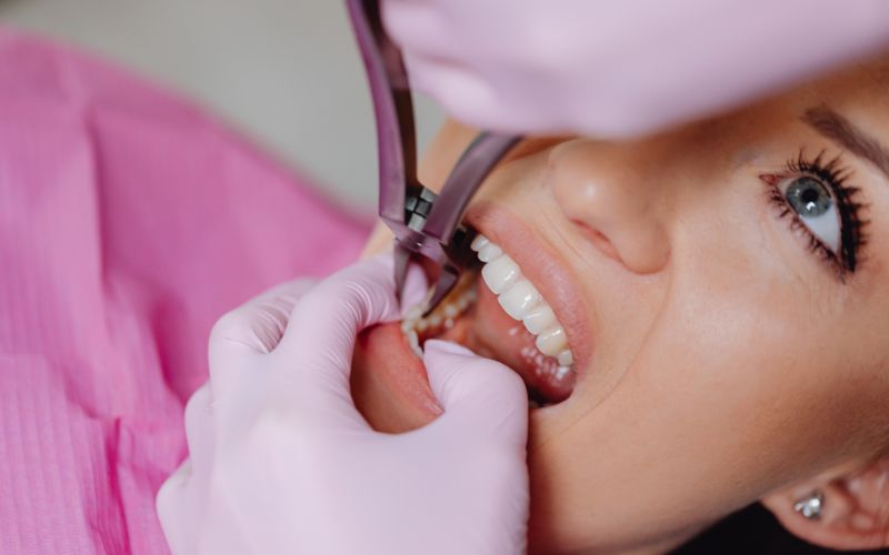 Suchy zębodół – kiedy się pojawia i jakie są jego objawy? - Dental Arts ...